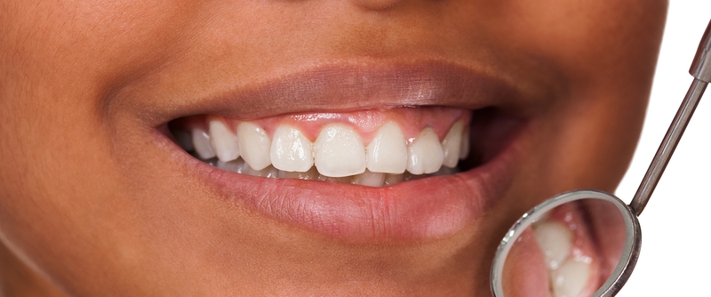 Gum Disease Treatment in Monument | Woodmoor Family Dentistry